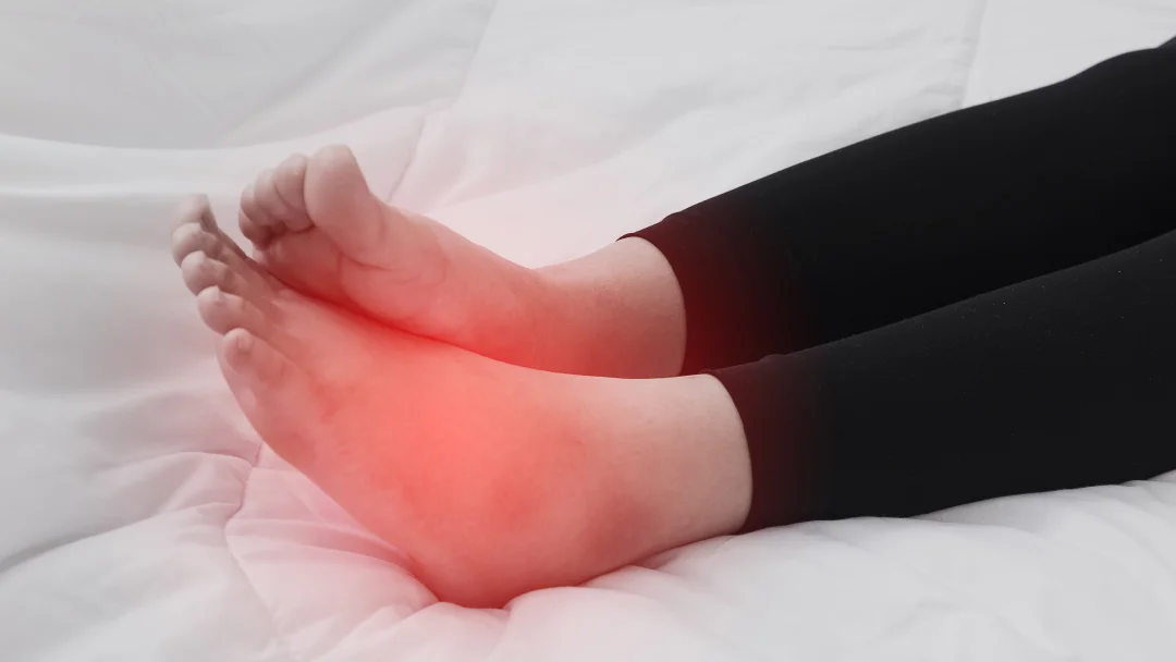 Swollen Feet: A Comprehensive Guide to Causes, Symptoms, and Prevention ...
